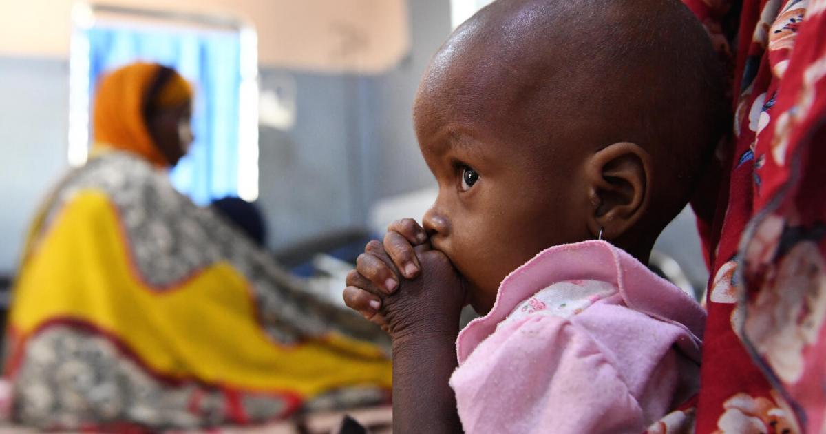 GLOBAL HUNGER CRISIS PUSHING ONE CHILD INTO SEVERE MALNUTRITION EVERY ...